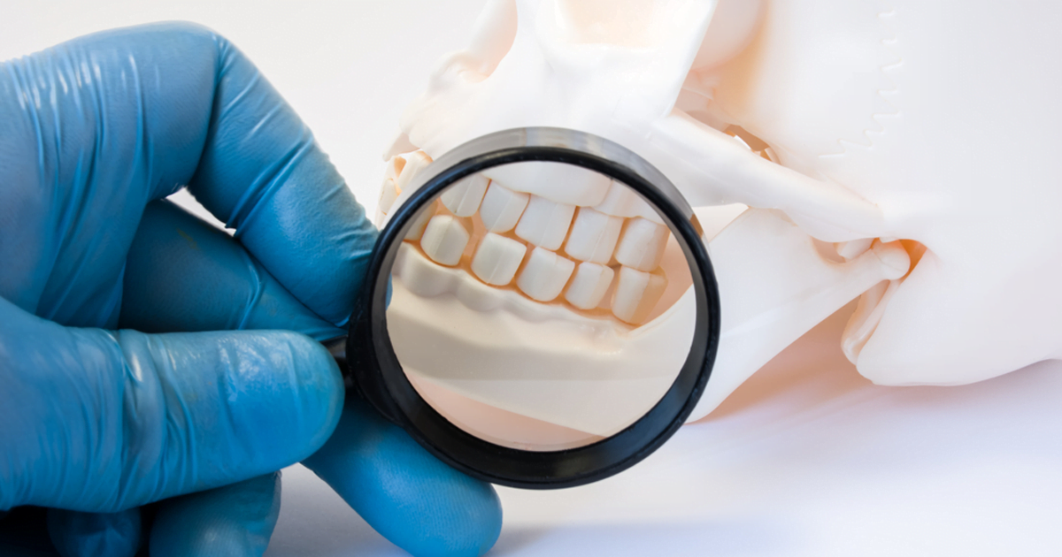 Rare & Unusual Tooth Disorders Causes Everyone Should Know